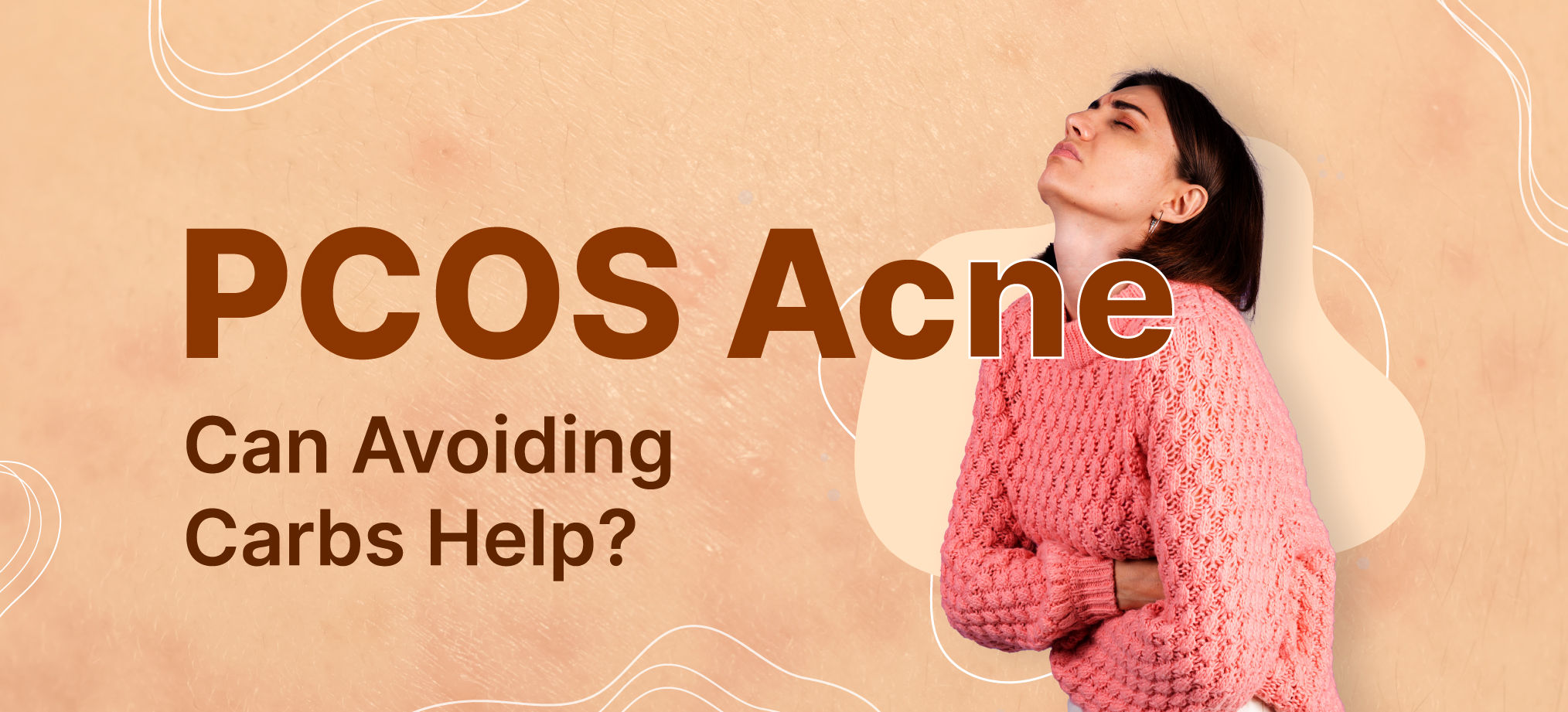 7 Tips To Manage PCOS Acne