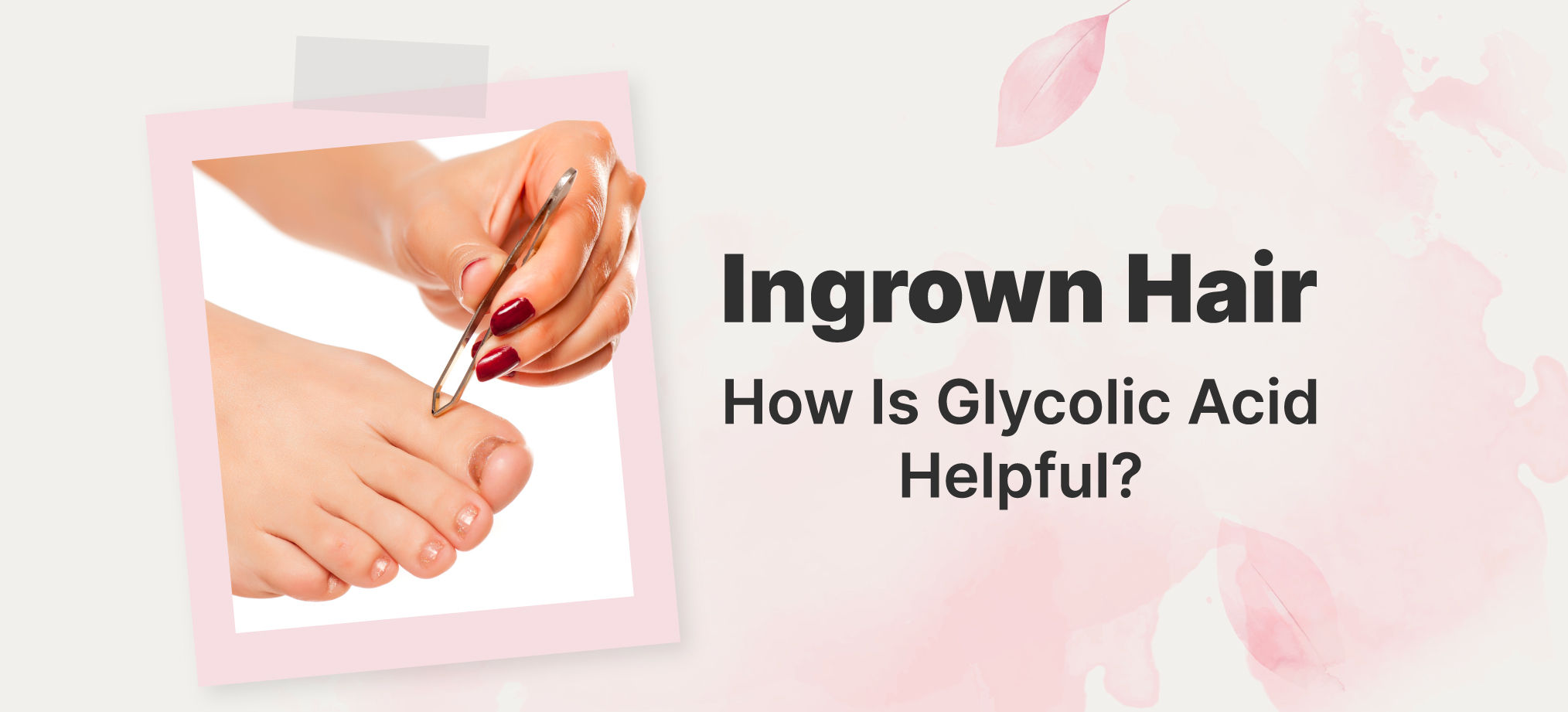 5 Tips By Dermatologists To Prevent Ingrown Hair