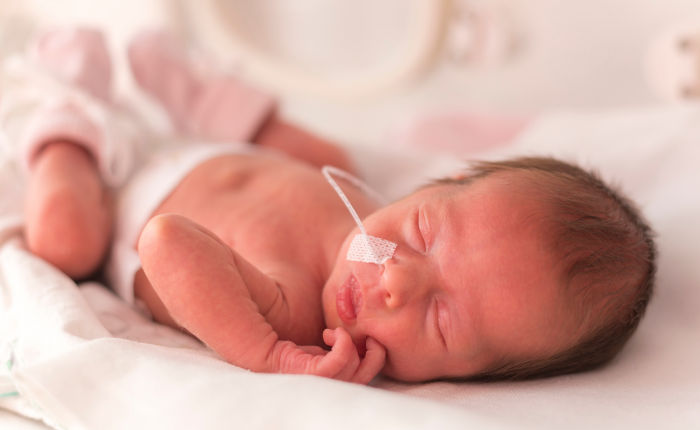 Preterm Birth- Causes, Complications and Care