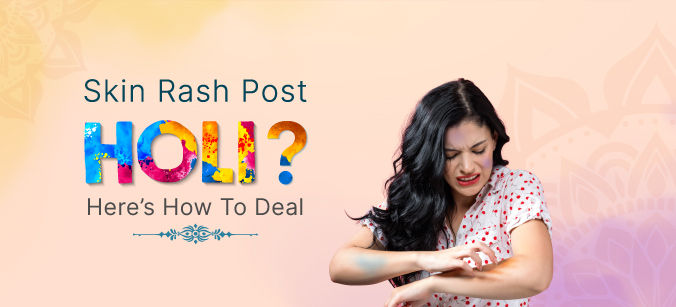 How To Prevent And Treat Rashes Triggered By Holi Colours?