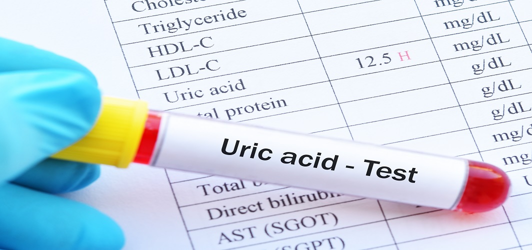 How Do Uric Acid Levels Affect Your Health?