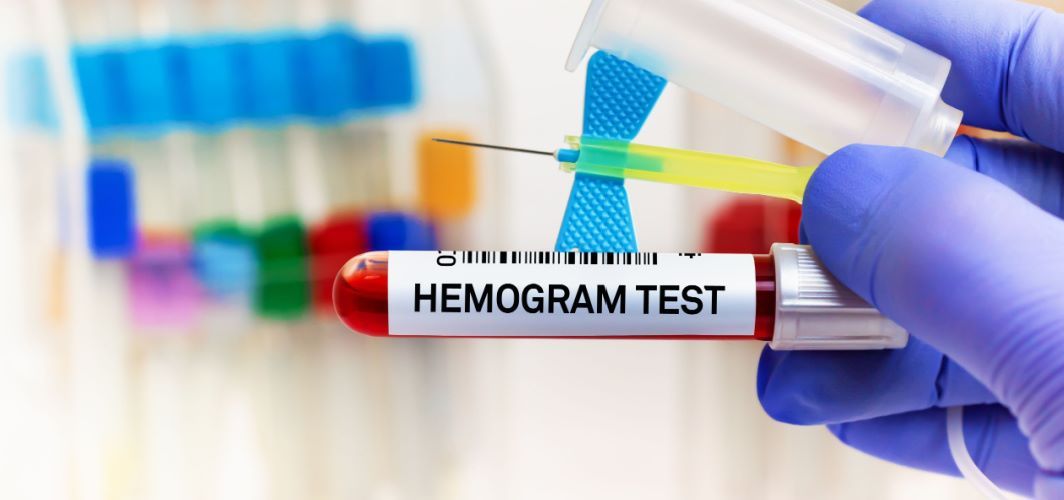 When To Get A Complete Hemogram Test?