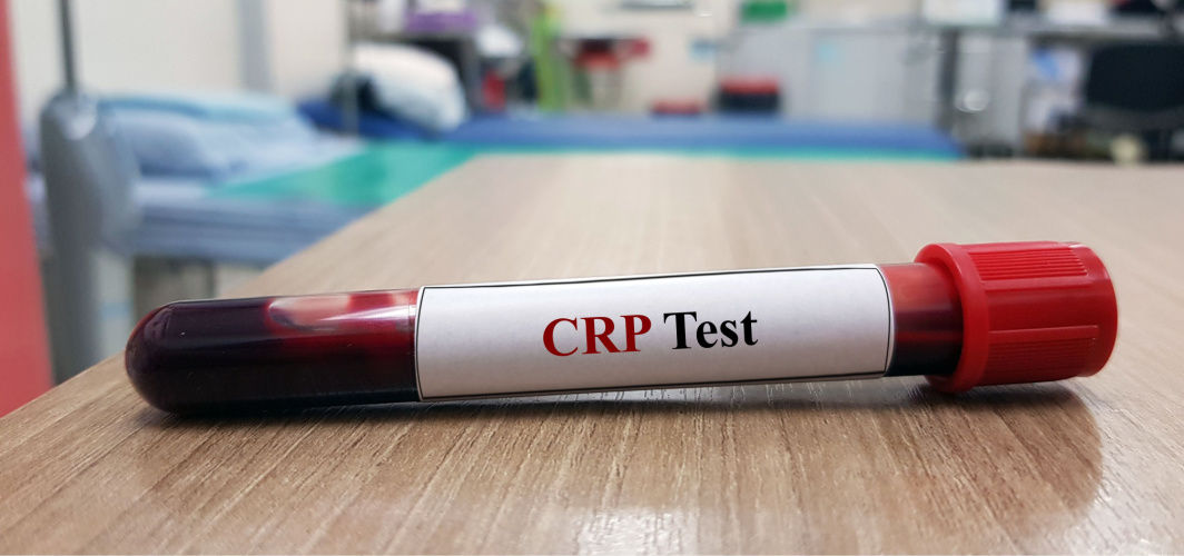 C- Reactive Protein (CRP) Test: Readings And Ways To Lower It