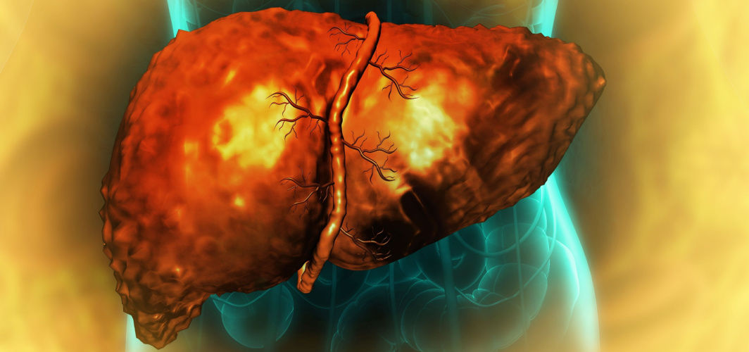 Early Warning Signs of Liver Damage: What You Should Know