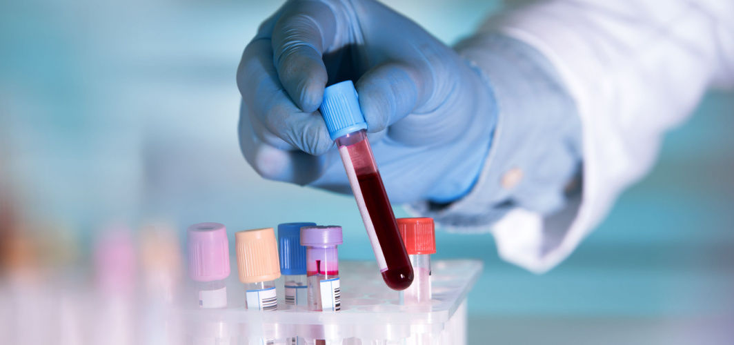 Blood Culture Test: Timing and Significance