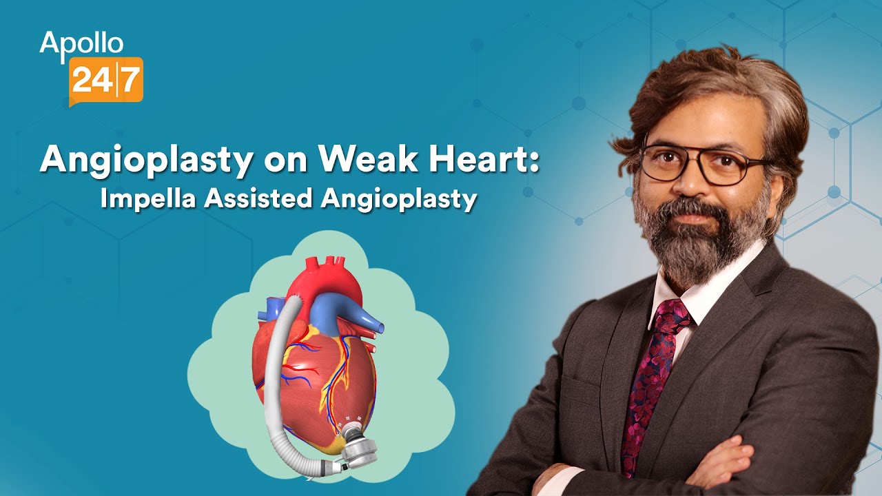 Dr. Rahul Gupta, Cardiologist in Mumbai, Book an Appointment, Consult ...