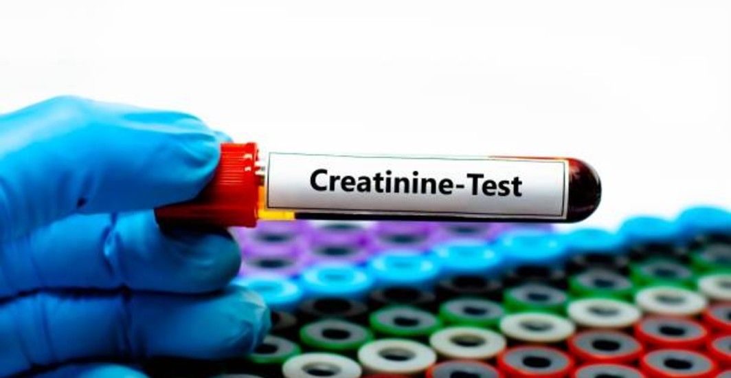 RFT Test Normal Range: Understanding Kidney Function Tests