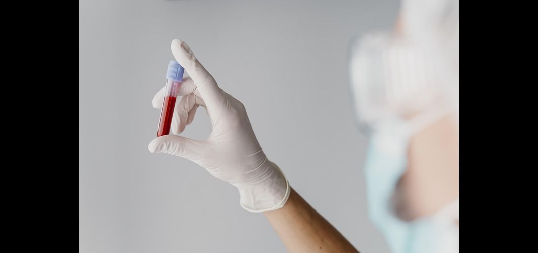 CRP Normal Range: Understand Your Results