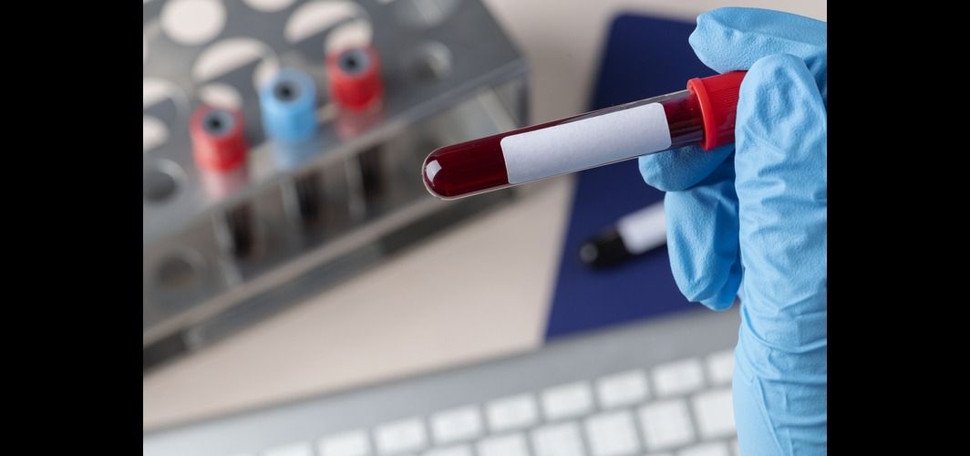 Platelet Count (PLT) Normal Range: Quick Reference Guide