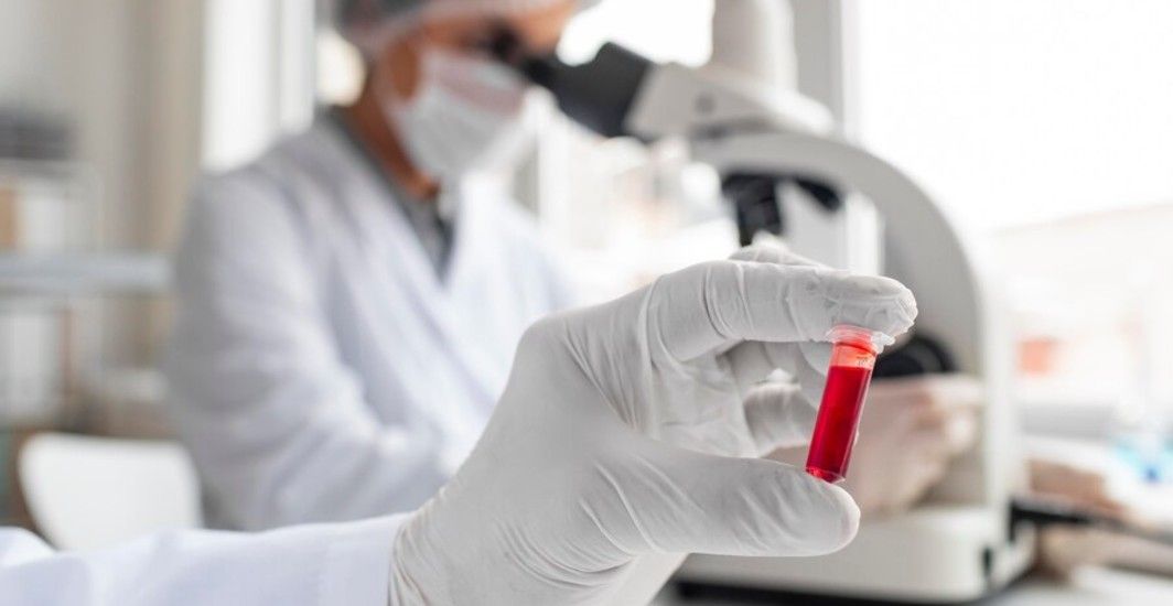 PDW Blood Test: What It Measures & Its Impact on Your Health