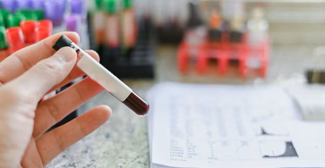 What Level of Alkaline Phosphatase is Dangerous? Understanding the Risks