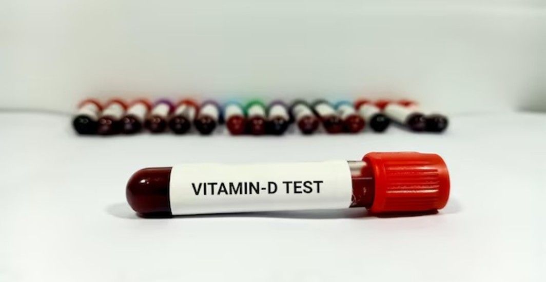 Vitamin D Test: Purpose, Procedure, Normal Range and Results