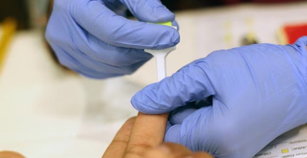 Anti-CCP Test: Purpose, Procedure, Range, and Results