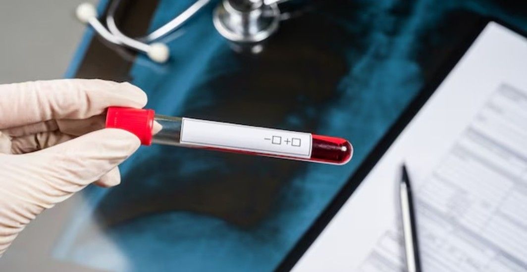 Leptin Test: Purpose, Procedure, Range, and Results