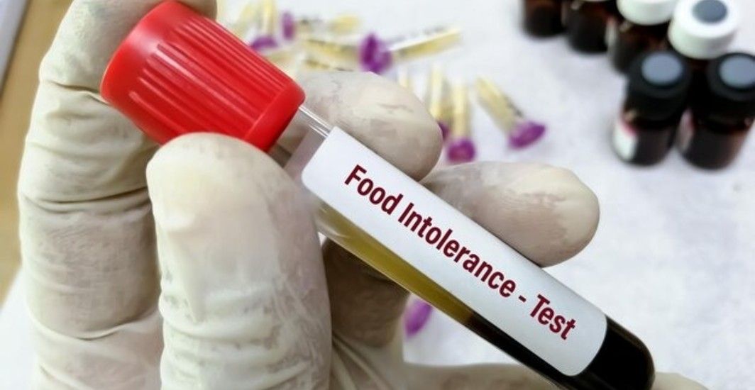 Food Intolerance Test: Purpose, Procedure, Range, and Results