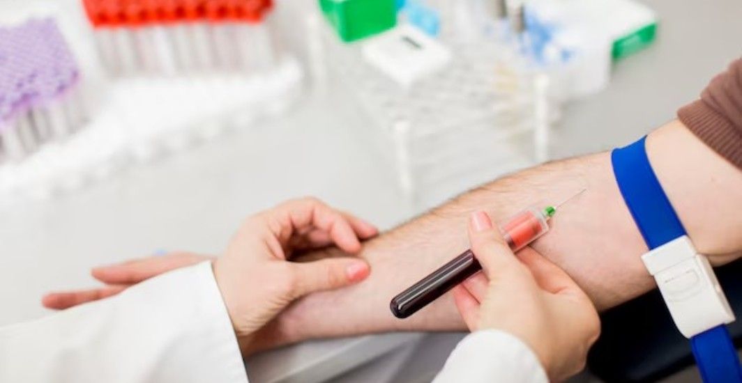 SGPT Test: Normal Range, Purpose, Procedure and Results