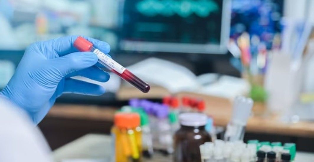 Creatine Kinase MB Test: Purpose, Procedure, Range, and Results