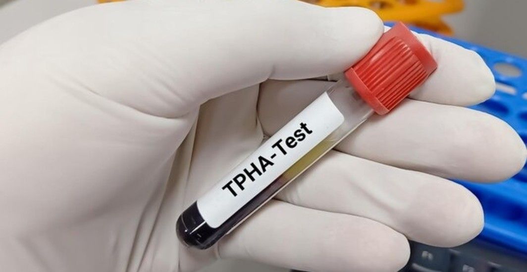 TPHA Test: Purpose, Procedure, Results, and Interpretation