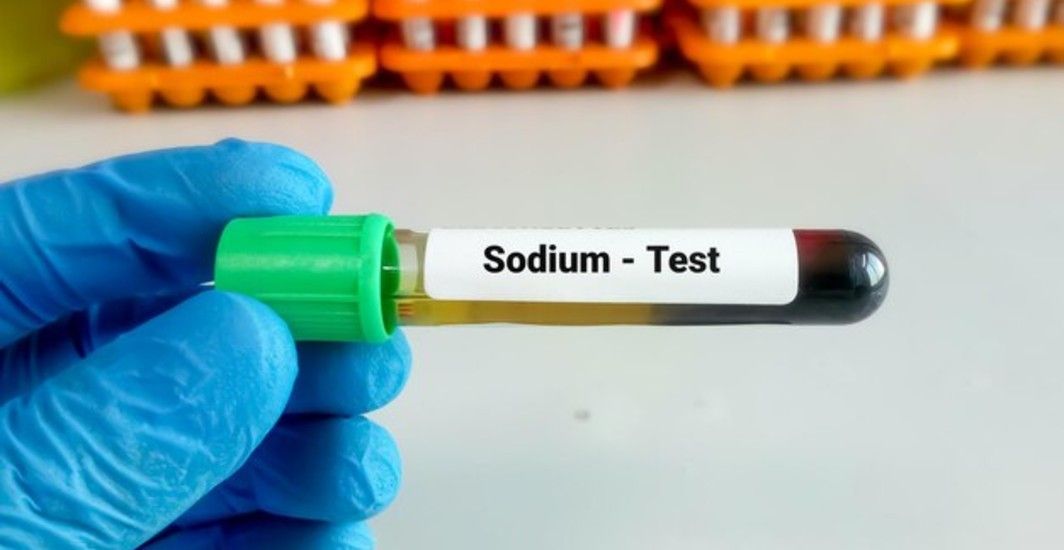Sodium Test: Purpose, Procedure, Range, and Results