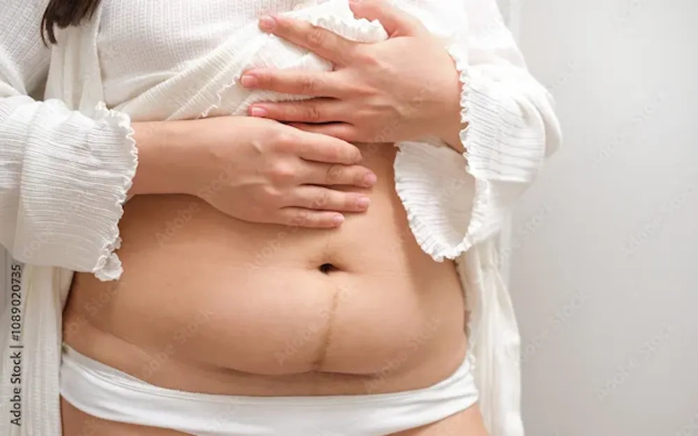 bad chest after c section