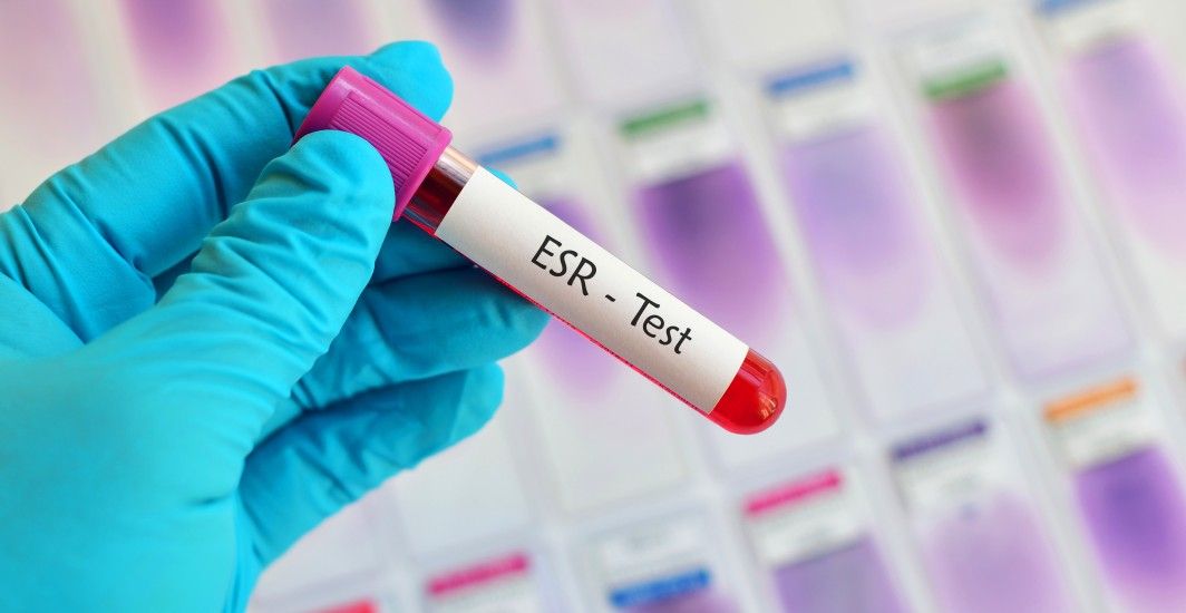 ESR Test - Normal Range, Purpose, Procedure And Results Interpretation