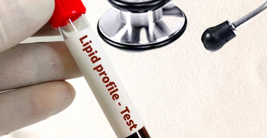 Lipid Profile Test - Normal Range, Purpose, Procedure And Results ...
