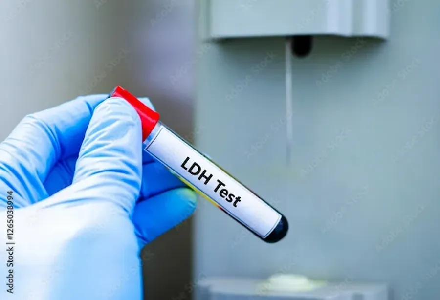 How To Reduce Ldh Level?