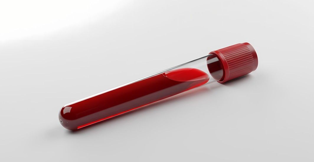 Red Blood Cell (RBC) Test – Normal Range, Purpose, Procedure and ...