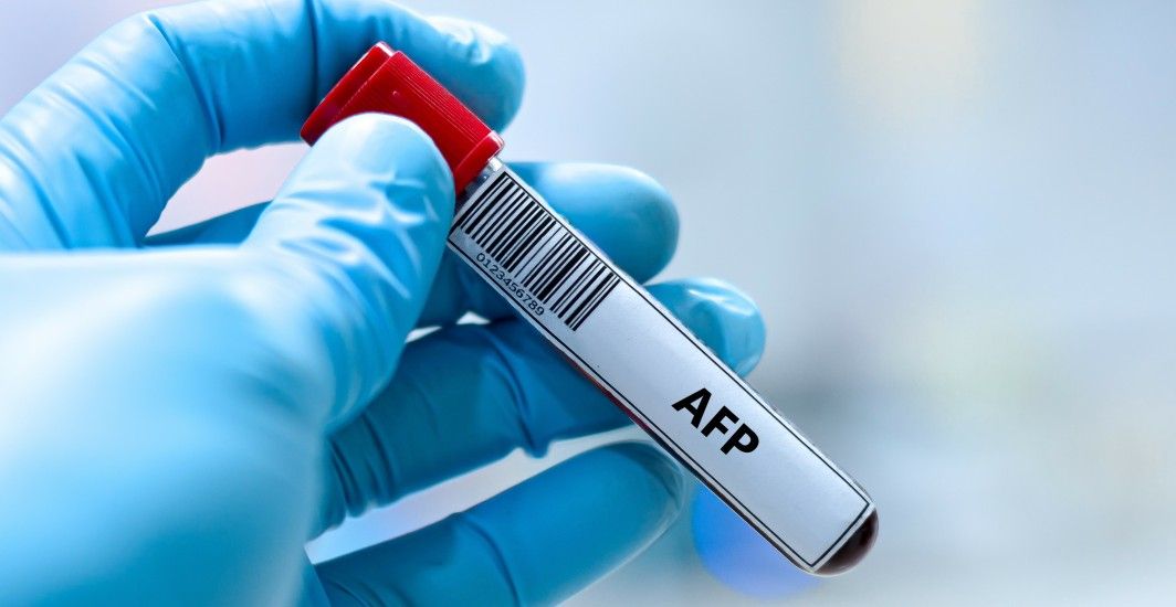 Monitoring Pregnancy or Cancer Risk? An AFP Test Helps Detect Foetal or ...