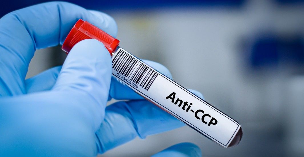 Having Stiff Joints? Know How An Anti-CCP Test Can Help Detect ...