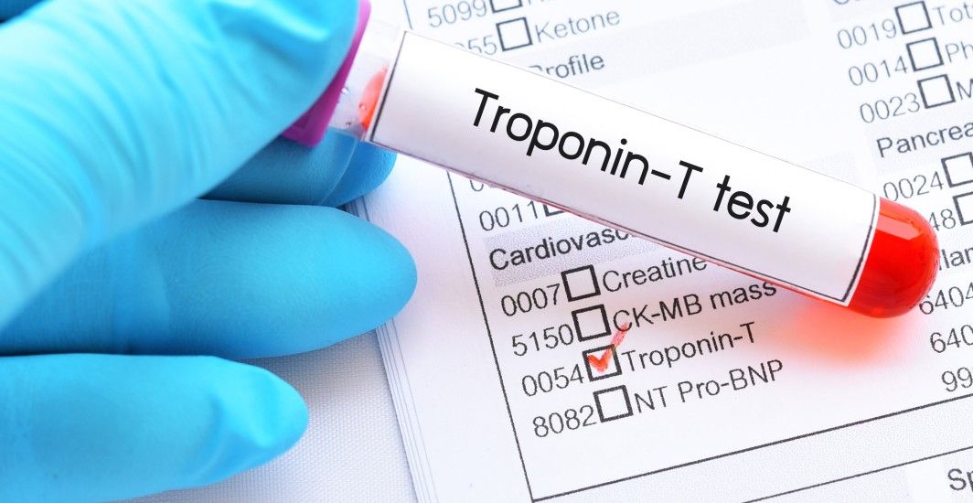 Troponin Test – Normal Range, Purpose, Procedure, and Results ...