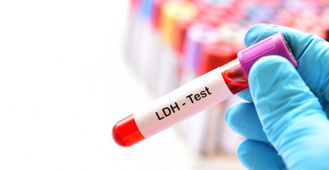 LDH Test – Normal Range, Purpose, Procedure, and Results Interpretation