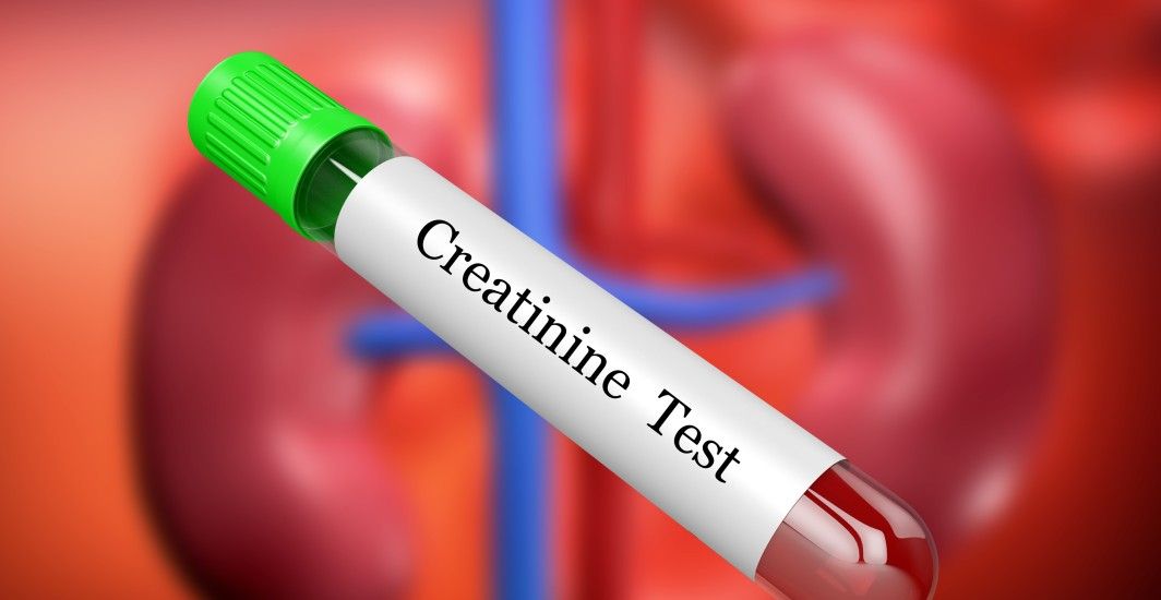 Feeling Bloated or Noticing Changes in Urination? Know How a Creatinine ...