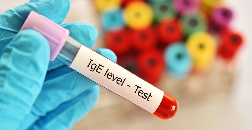 IgE Test – Normal Range, Purpose, Procedure, and Results Interpretation