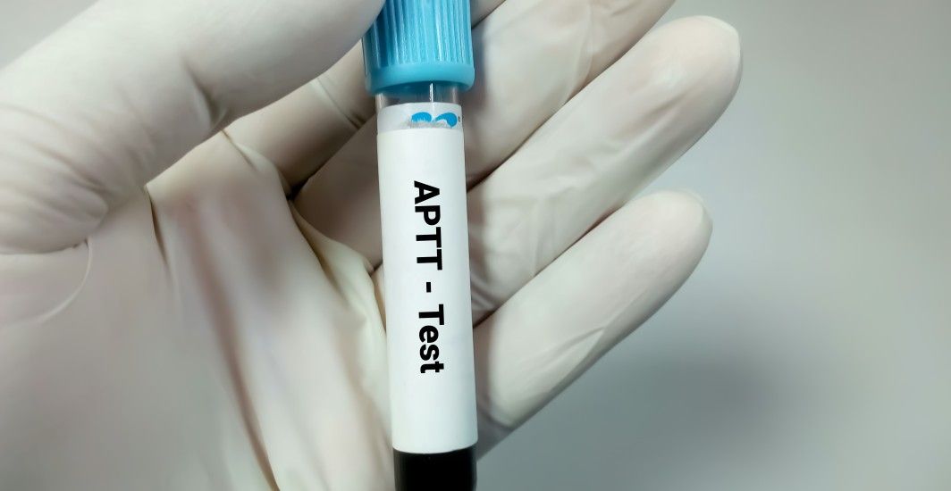 On Blood Thinners or Facing Unexplained Bleeding? An APTT Test Can ...