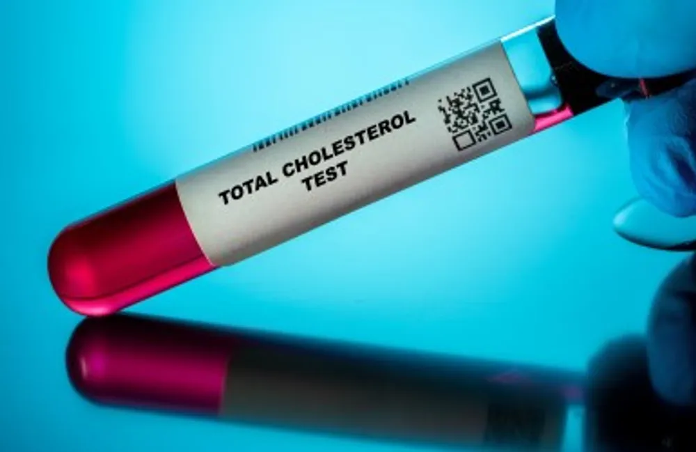 total cholesterol levels normal