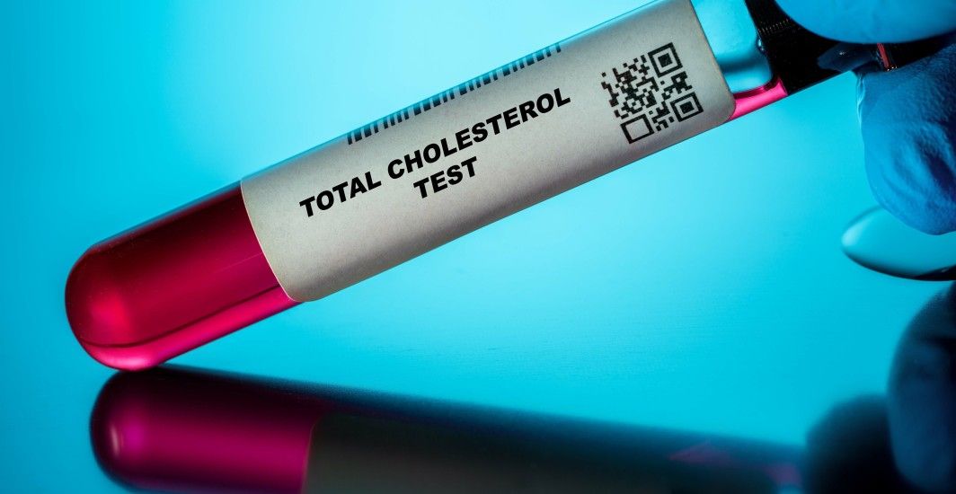Total Cholesterol Test – Normal Range, Purpose, Procedure, And Results ...