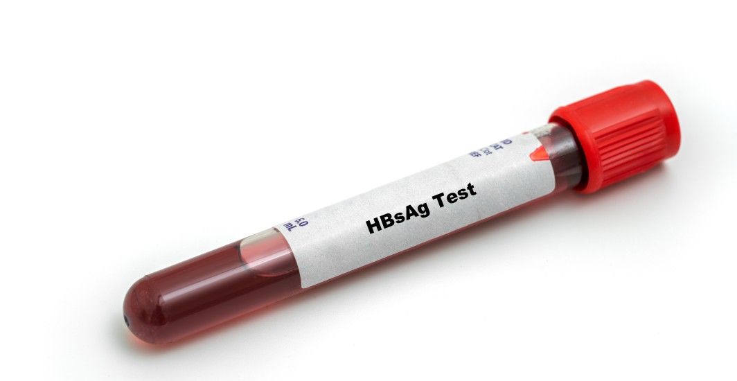 Have You Ever Had Unprotected Sex Or A Blood Transfusion? Check What An ...