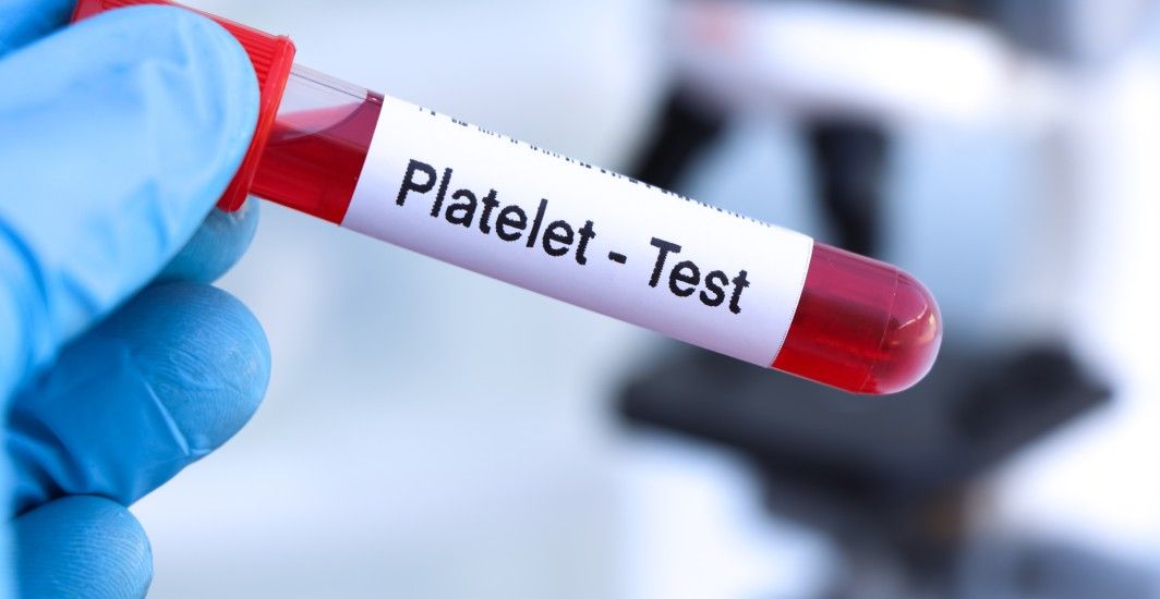 Platelet Count – Normal Range, Purpose, Procedure, And Results ...