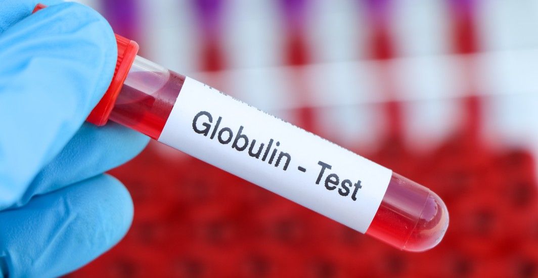 Globulin Test – Normal Range, Purpose, Procedure and Results Interpretation