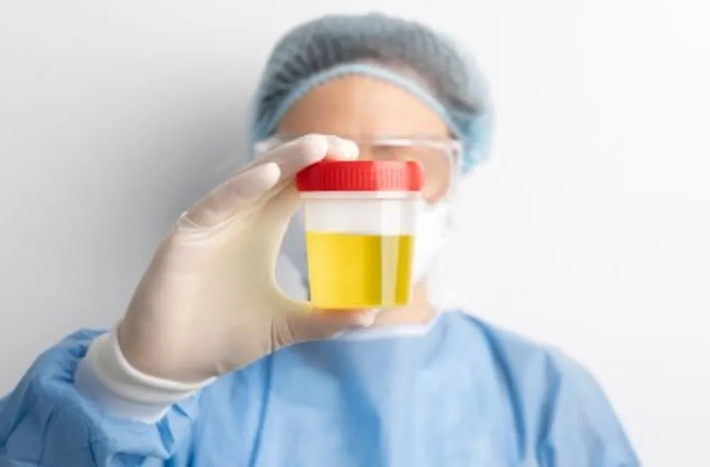 urine test report normal range