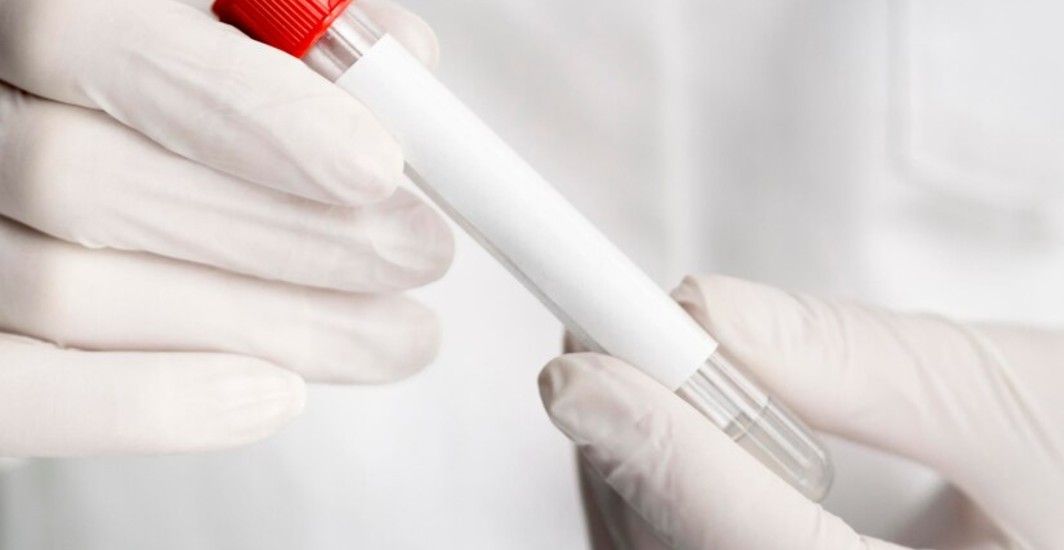 WBC Test - Normal Range, Purpose, Procedure And Results Interpretation