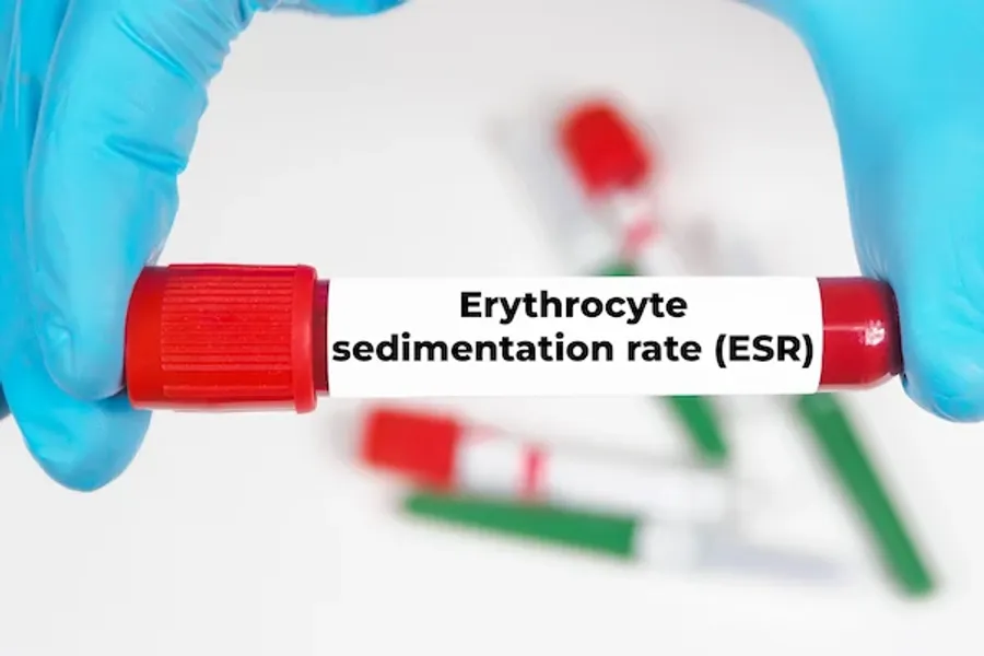 How To Reduce ESR In Blood?
