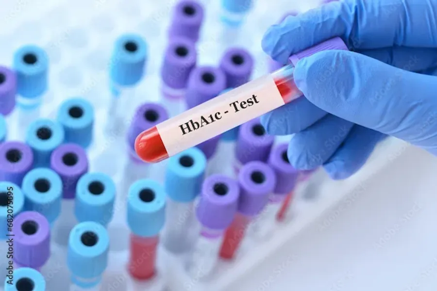 How to Reduce HbA1c Levels?