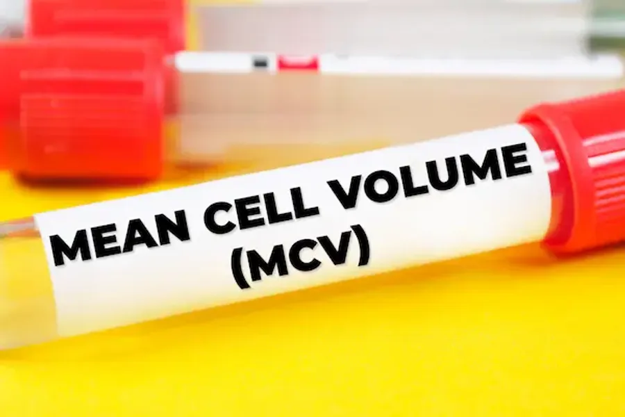 MCV Full Form in Medical Terms