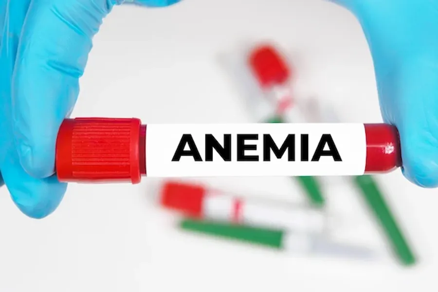 Best Iron Deficiency Blood Test Package For Women