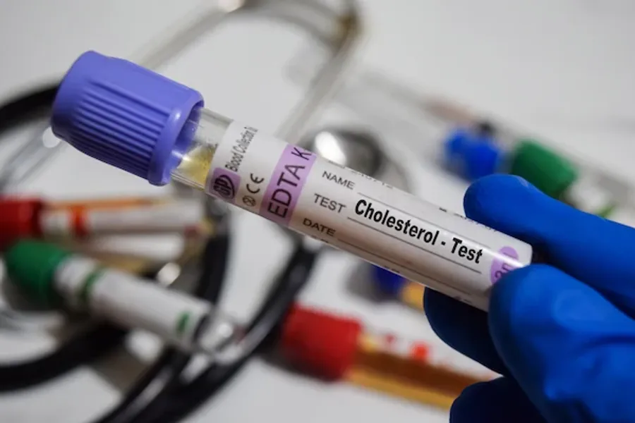 Cholesterol Test Vs. Lipid Profile Test Packages