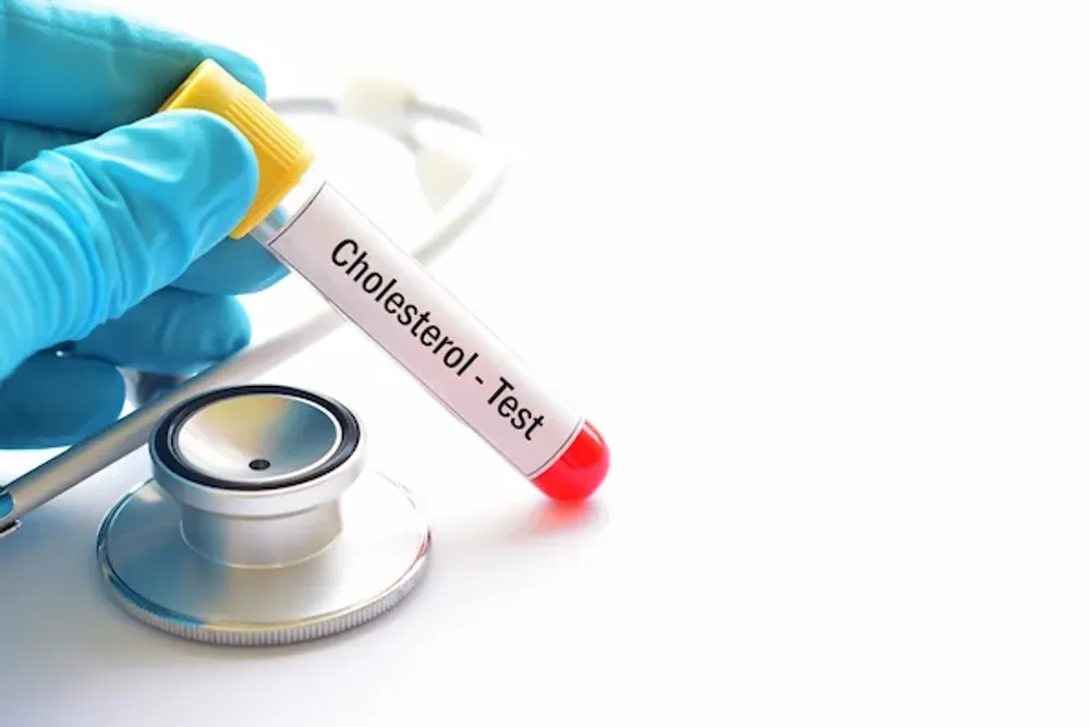 cholesterol test
