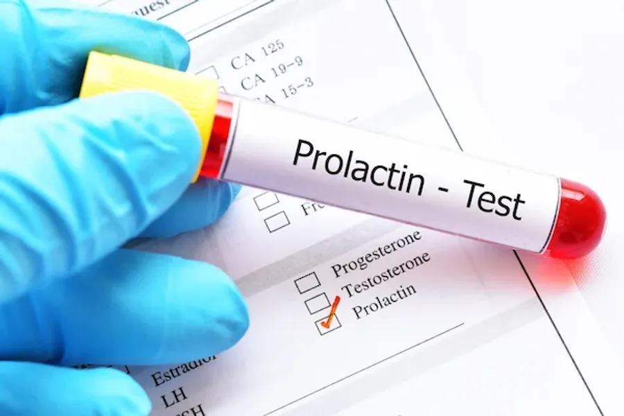 High Prolactin Levels: What It Means for Your Period and Fertility