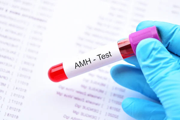AMH Test and Normal Blood Levels